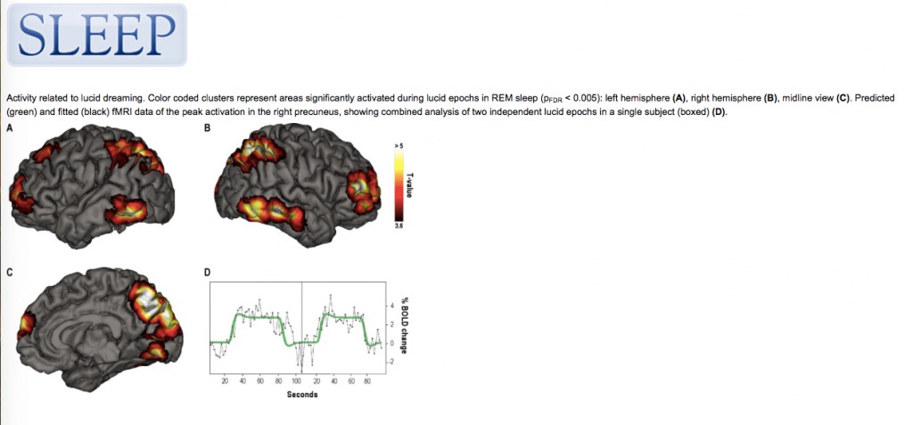 Lucid Dreaming or Dreaming That You’re Dreaming? — The Brains Blog